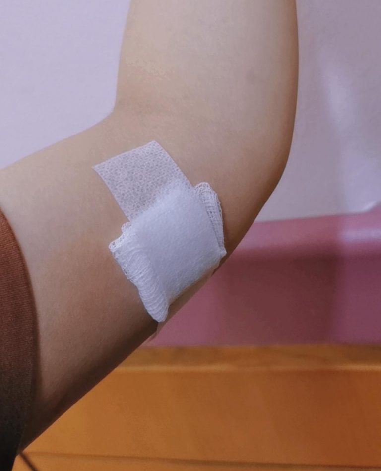 Take a Look | Implanon - In & Out | It's Zoelie & Her Blog